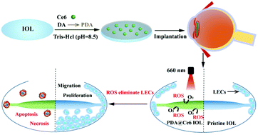 A polydopamine-based photodynamic coating on the intraocular lens ...