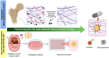 Osteomatrix as a personalized 3D tissue-specific invasion test-bed for ...