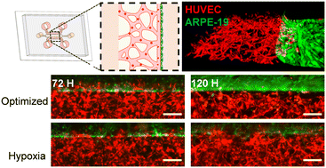Microfluidic outer blood–retinal barrier model for inducing wet age ...