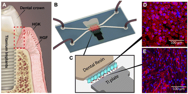 A dental implant-on-a-chip for 3D modeling of host–material–pathogen ...