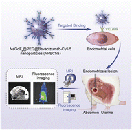 Endometriosis-targeted MRI imaging using bevacizumab-modified ...