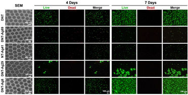 Balancing the antibacterial and osteogenic effects of double-layer TiO2 ...