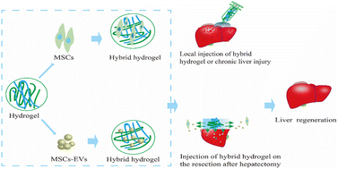 Hydrogels as carriers deliver stem cells/exosomes for liver injury ...