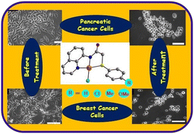 Pd(ii) complexes bearing NNS pincer ligands: unveiling potent ...