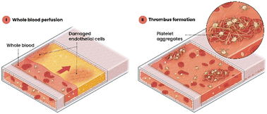 Blood-perfused Vessels-on-Chips stimulated with patient plasma ...