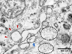 Release of extracellular vesicles triggered by low-intensity pulsed ...