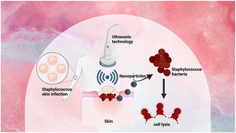 Ultrasonic nanotechnology for the effective management of ...