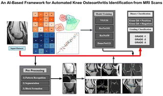 MRI detection and grading of knee osteoarthritis – a pilot study using an AI technique with a ...