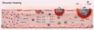 An infection microenvironment-responsive multifunctional nanocomposite ...