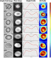 3D quantitative phase imaging via the transport of intensity equation ...