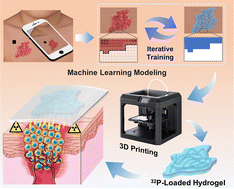 A customizable 32P hydrogel applicator for brachytherapy of skin ...