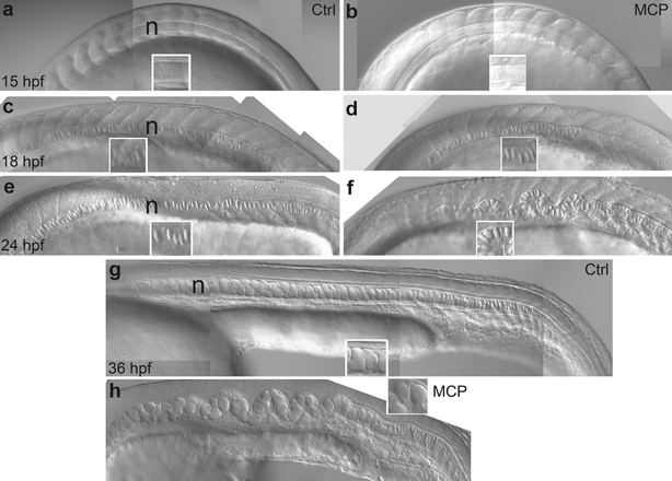 Chemical genetics suggests a critical role for lysyl oxidase in ...