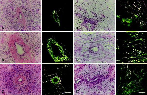 A bioengineered heterotypic stroma–cancer microenvironment model to ...