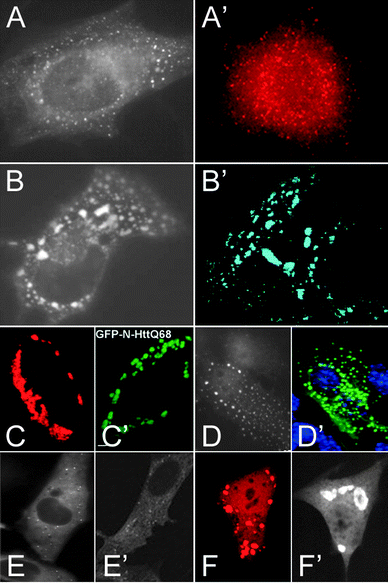 Revisiting and revising the purinosome - Molecular BioSystems (RSC ...