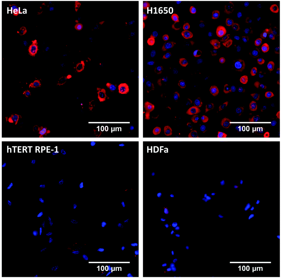 A polyamine-modified near-infrared fluorescent probe for selective ...