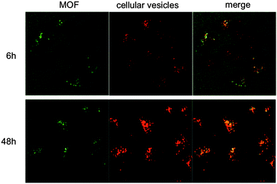 MOF nanoparticles coated by lipid bilayers and their uptake by cancer ...