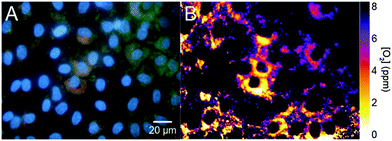 An overview of nanoparticles commonly used in fluorescent bioimaging ...