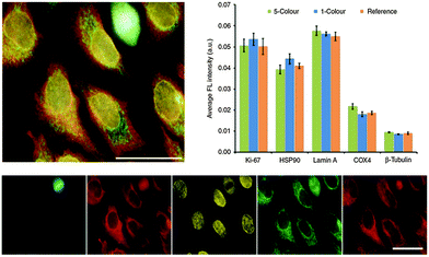 Quantum dots: bright and versatile in vitro and in vivo fluorescence ...