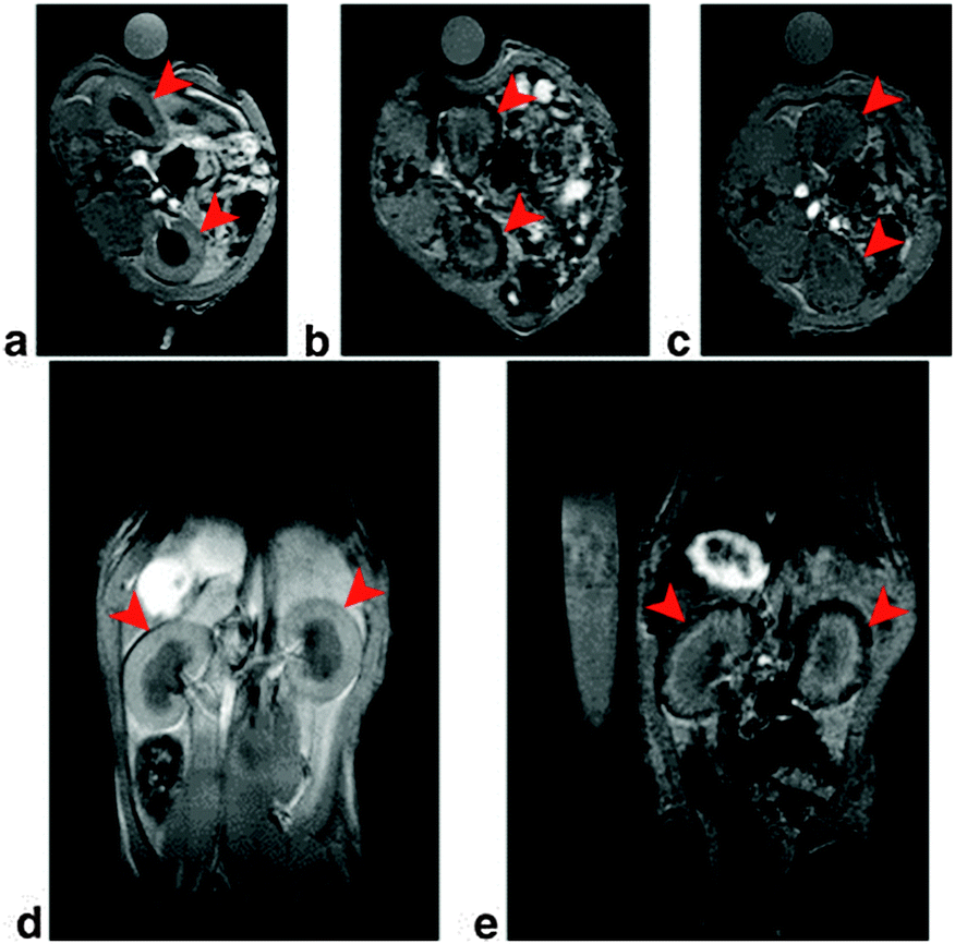 Design considerations for the synthesis of polymer coated iron oxide ...