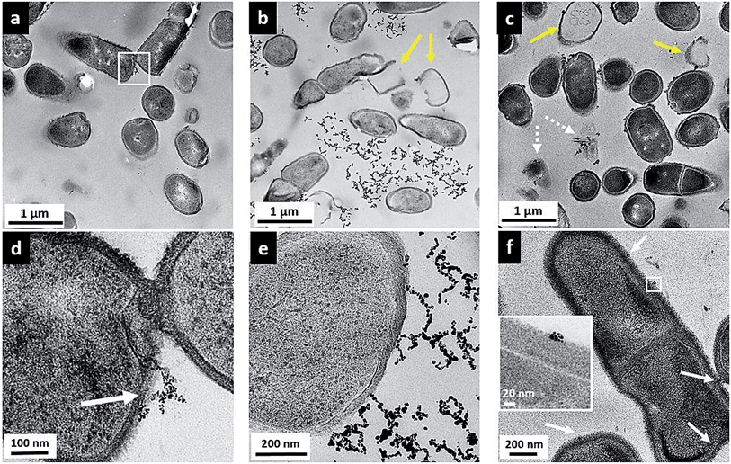 Impacts of gold nanoparticle charge and ligand type on surface binding ...