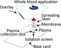 Microfluidic blood plasma separation for medical diagnostics: is it ...