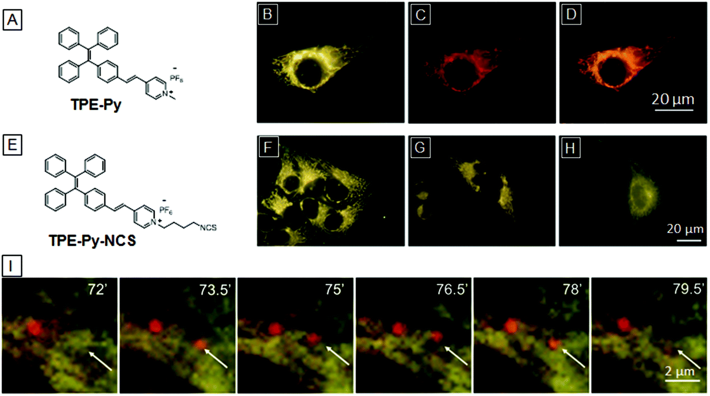 Organelle-specific bioprobes based on fluorogens with aggregation-induced emission (AIE ...