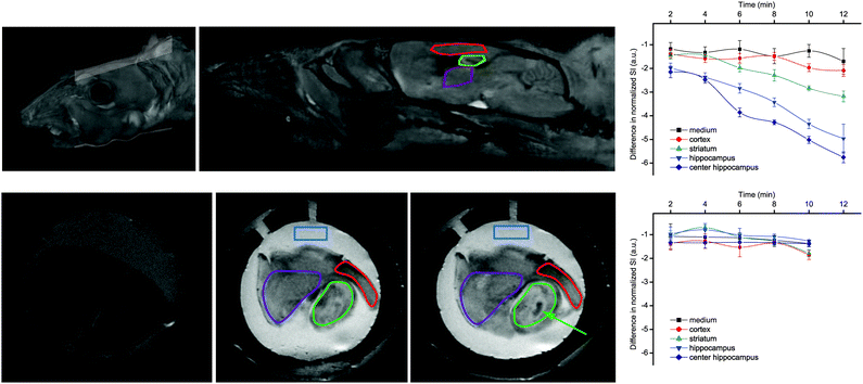 Strategies for sensing neurotransmitters with responsive MRI contrast ...