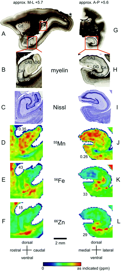 Whole-brain metallomic analysis of the common marmoset ( Callithrix ...