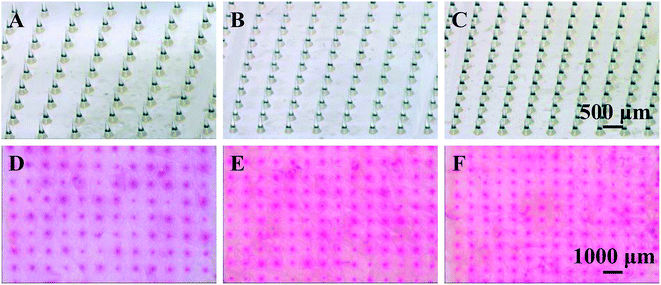 A solid polymer microneedle patch pretreatment enhances the permeation ...