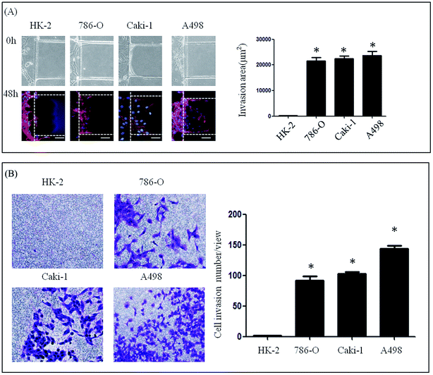 miRNA-21 promotes renal carcinoma cell invasion in a microfluidic ...