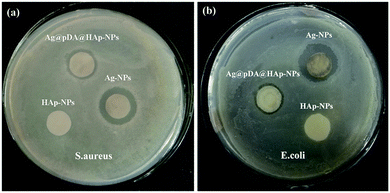 Fabrication of core–shell Ag@pDA@HAp nanoparticles with the ability for controlled release of Ag ...
