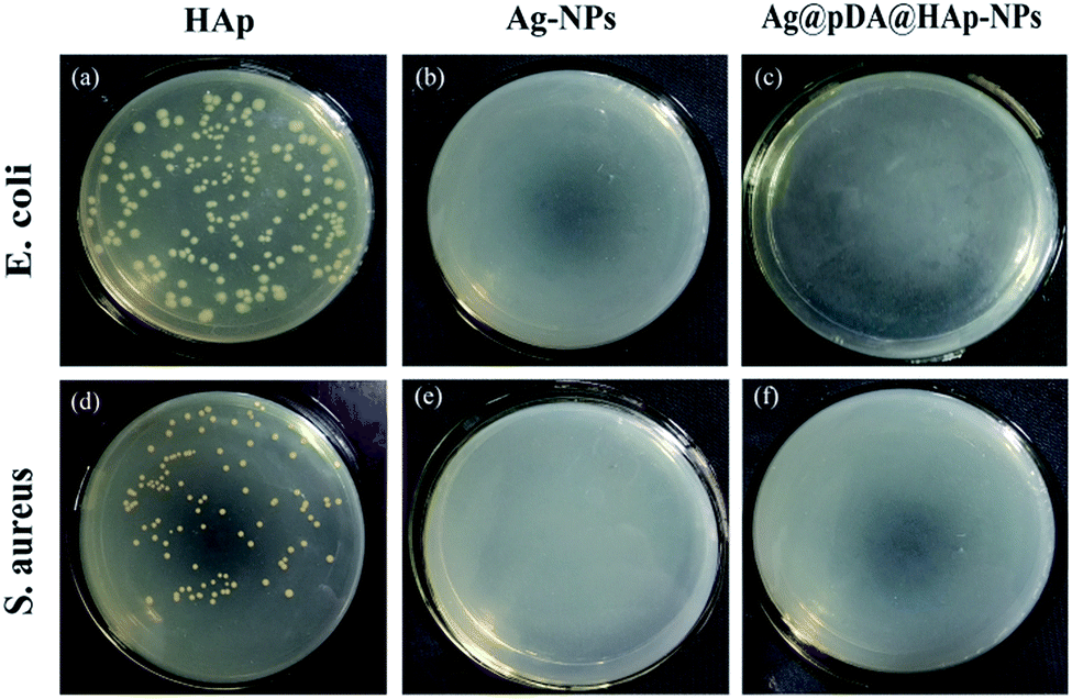 Fabrication of core–shell Ag@pDA@HAp nanoparticles with the ability for controlled release of Ag ...