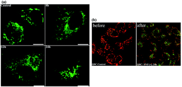 Dependence between cytotoxicity and dynamic subcellular localization of ...