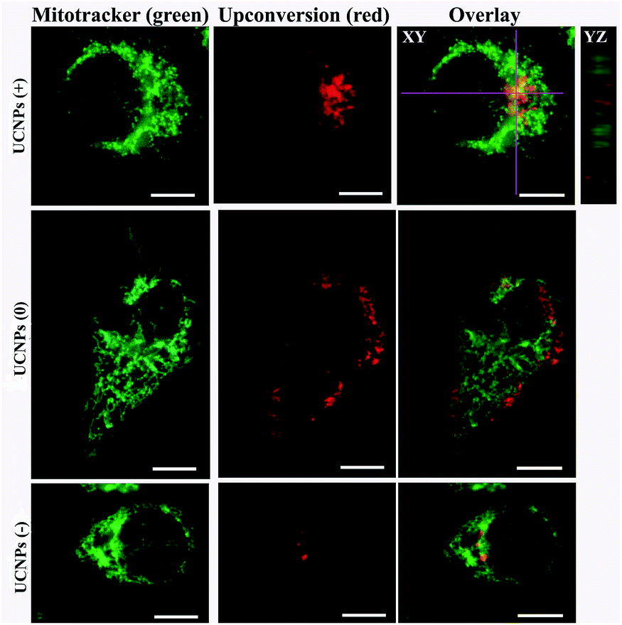 Dependence between cytotoxicity and dynamic subcellular localization of ...
