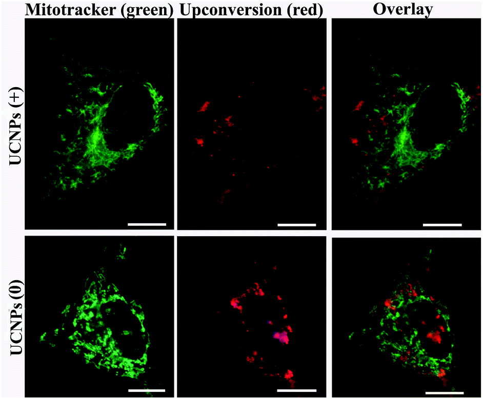Dependence between cytotoxicity and dynamic subcellular localization of ...