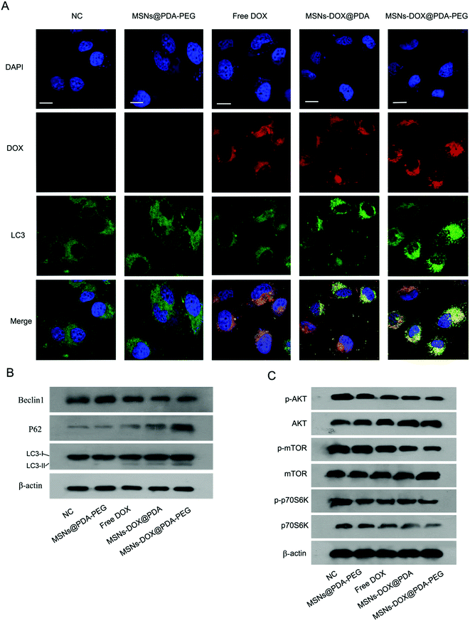 DOX-loaded pH-sensitive mesoporous silica nanoparticles coated with PDA ...