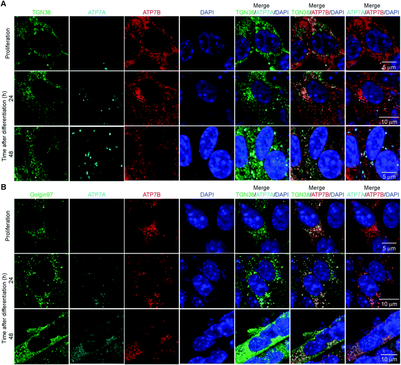 Dynamic changes in copper homeostasis and post-transcriptional ...