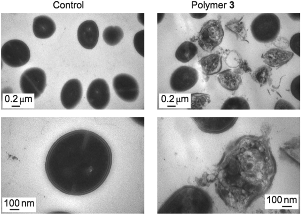 Biomimetic antimicrobial polymers: recent advances in molecular design ...