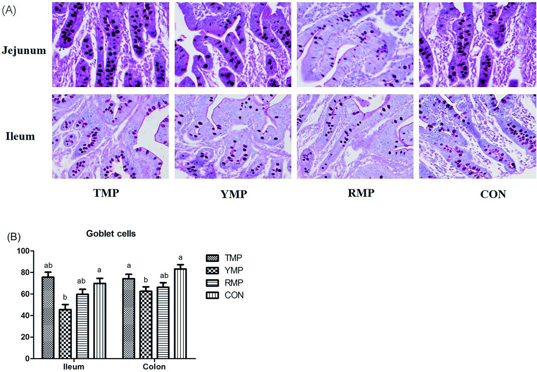 Modulation of intestine development by fecal microbiota transplantation ...