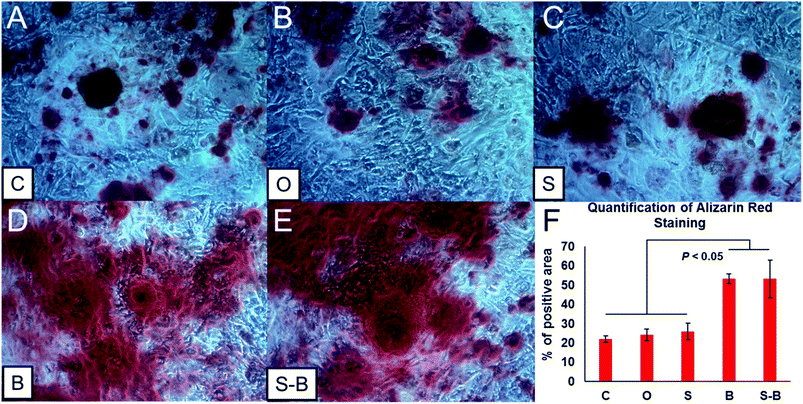Double-layered microsphere based dual growth factor delivery system for ...