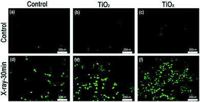 Dual-stimuli-responsive TiO x /DOX nanodrug system for lung cancer ...