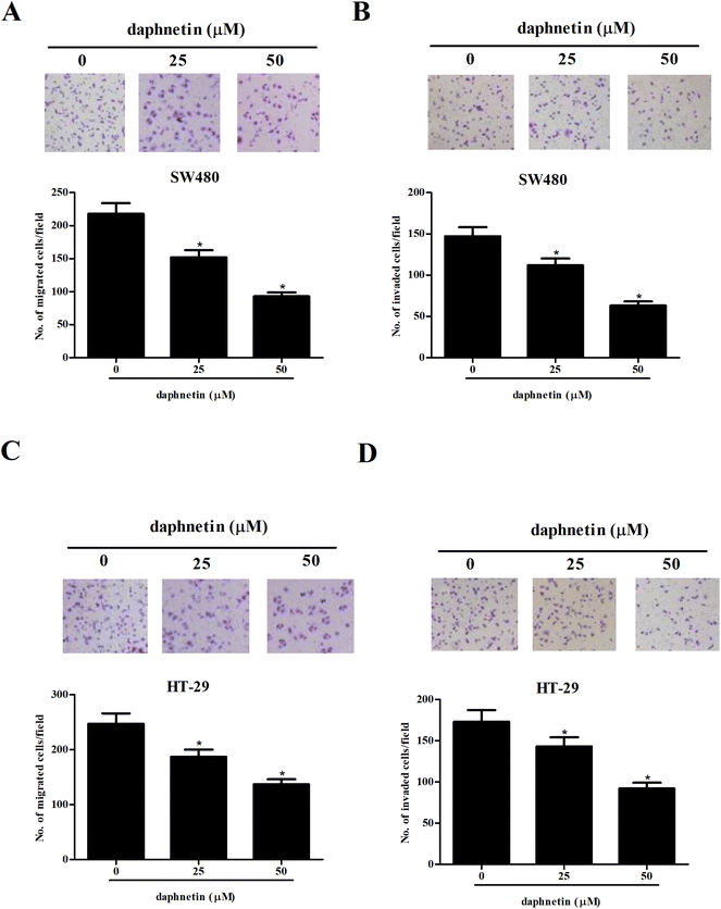 Retracted Article: Daphnetin inhibits proliferation and glycolysis in ...