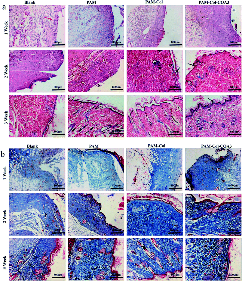 Tough and tissue-adhesive polyacrylamide/collagen hydrogel with ...