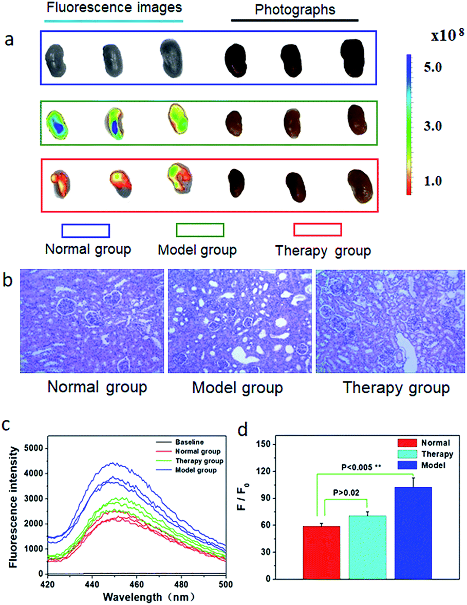 Treatment of hyperphosphatemia based on specific interactions between ...