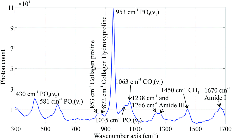 Chemical imaging of human teeth by a time-resolved Raman spectrometer ...