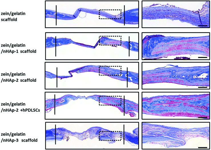 Zein/gelatin/nanohydroxyapatite nanofibrous scaffolds are biocompatible ...