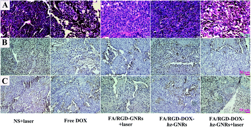 Dual targeted and pH-responsive gold nanorods with improved ...