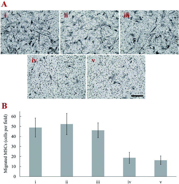 Migration of mesenchymal stem cells tethered with carbon nanotubes ...