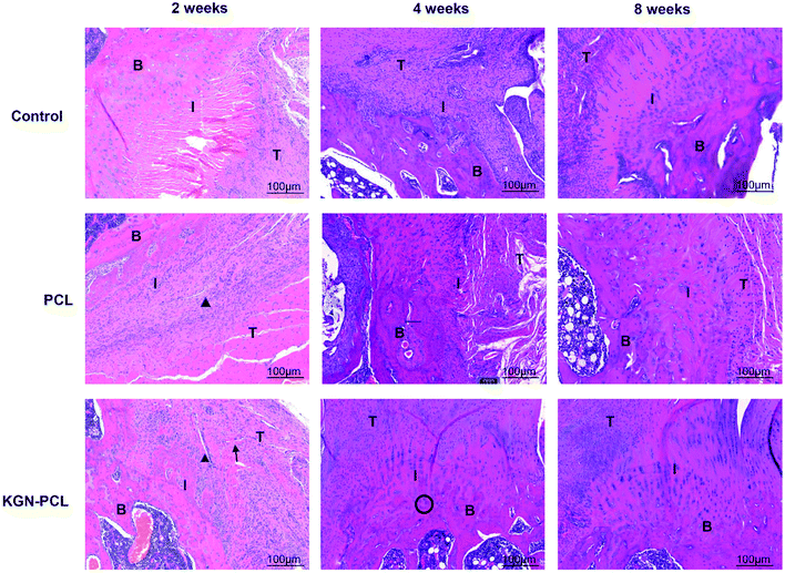 Enhancement of rotator cuff tendon–bone healing using combined aligned ...