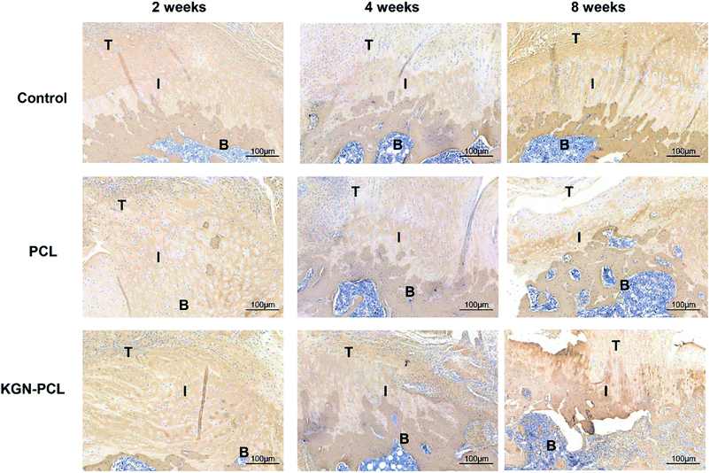 Enhancement of rotator cuff tendon–bone healing using combined aligned ...